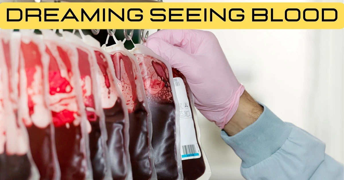 Dreaming Seeing Blood - Represents A Vital Energy Or Force
